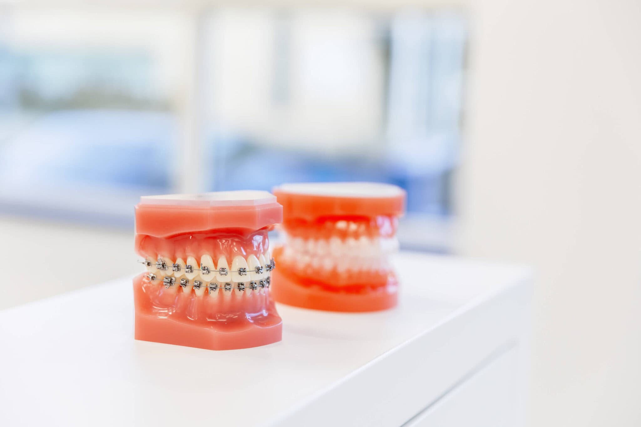 Behandelingen / Soorten Beugels - Orthodontiepraktijk Lent